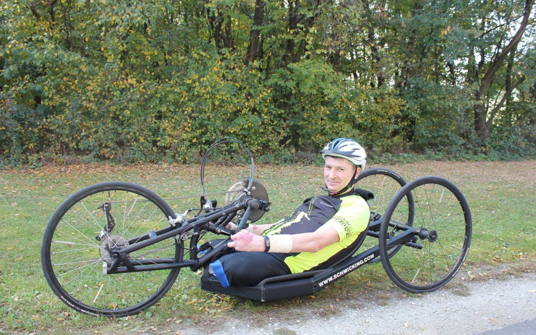 Čez noč ostal brez obeh nog in prstov na roki, doživel tudi zastoj srca ...